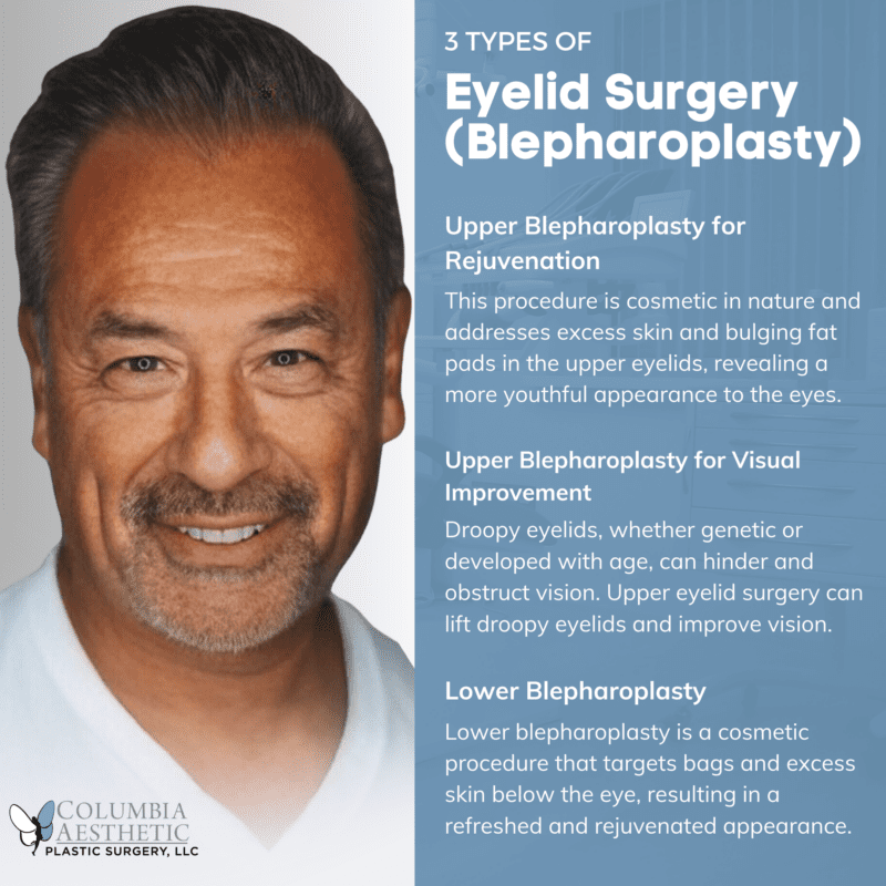 EYELID SURGERY (BLEPHAROPLASTY)